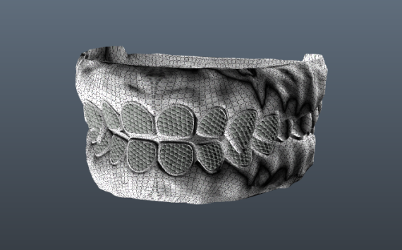 Progressive Code · Grill Teeth