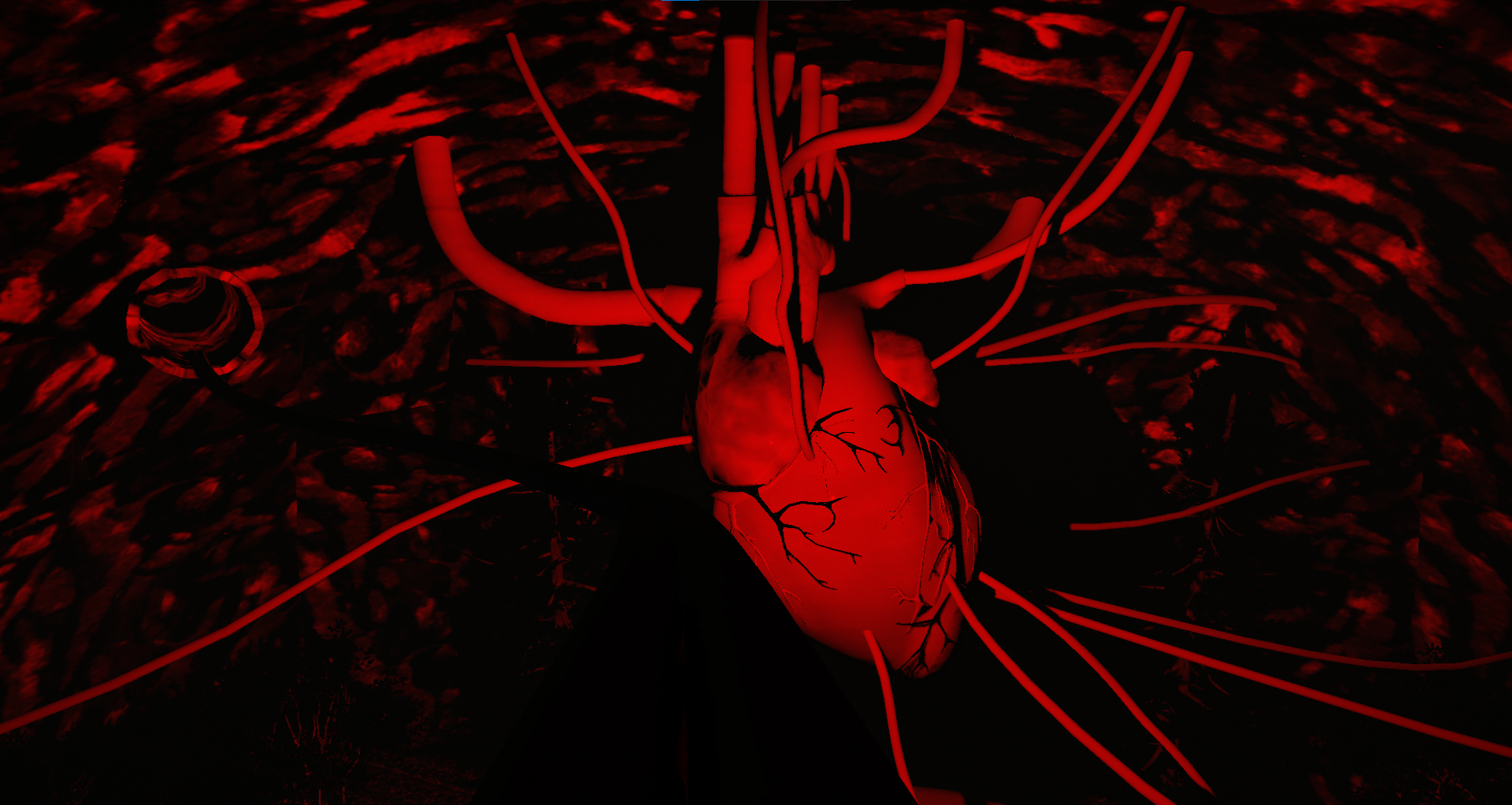 iProMx · Upside Down MLO